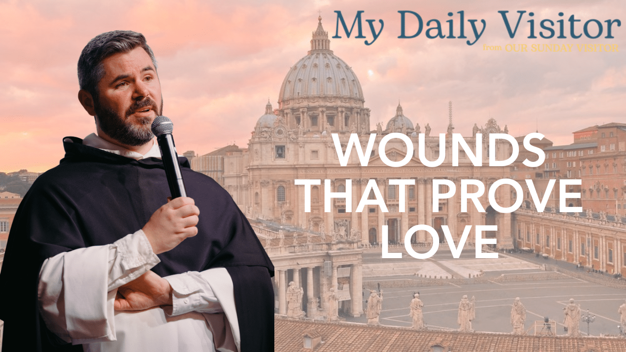 The wounds that prove love